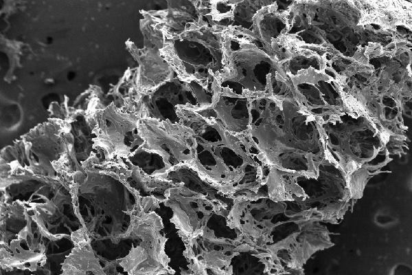 Faux Brain Tissue Could Help Monitor Architectural Repairs